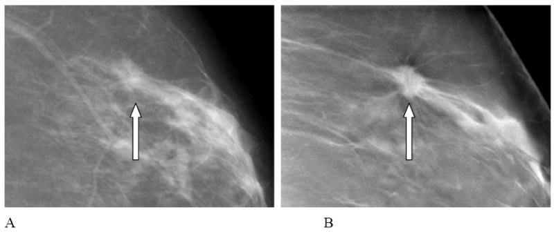 Super Resolution Imaging – For Better Medical Image Analysis - Median ...