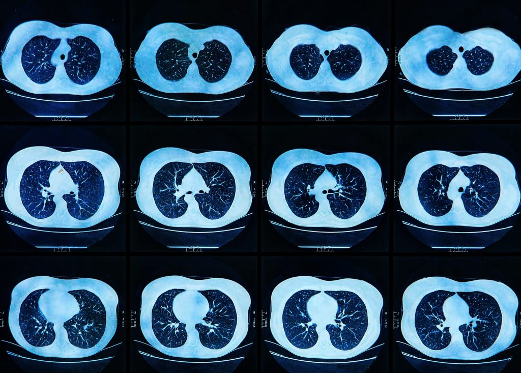 Medical Imaging Response Criteria: Morphological Measures - Median ...